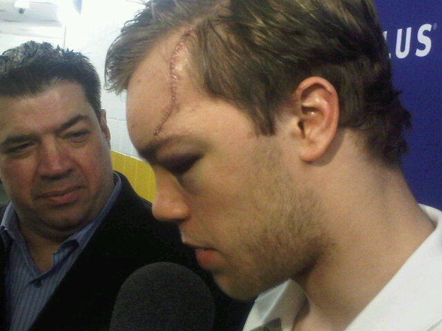 The Blair Necessities: Taylor Hall-The Aftermath