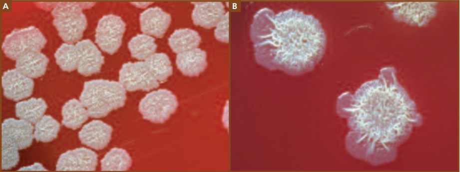 [Microbiology] Atlas of Growth Patterns on Agar | Free Medical Atlas
