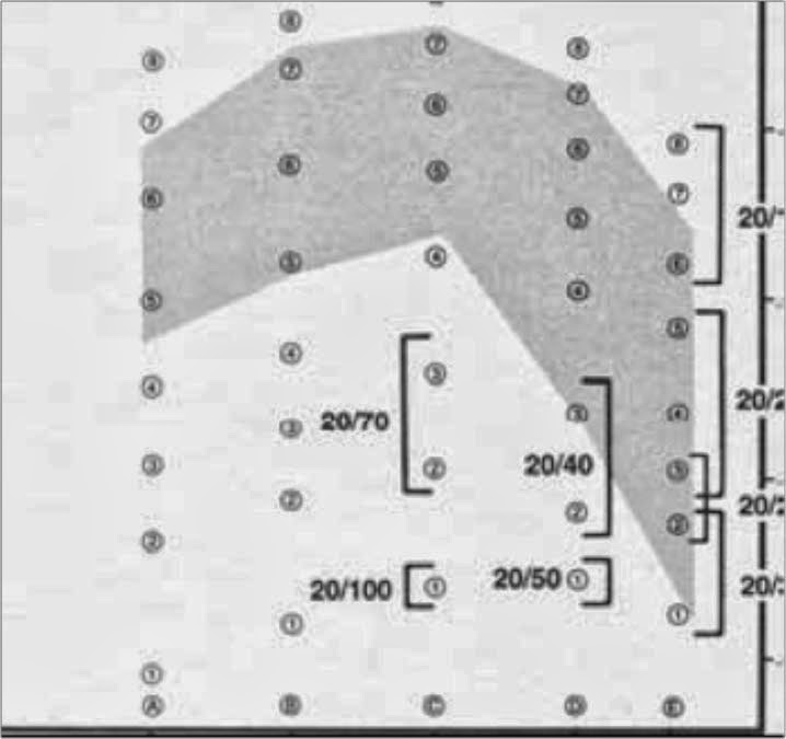 Dra. Lourdes Medina y Álvarez Tostado: Historia Clínica de la Visión ...