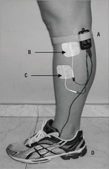 Functional Electrical Stimulation for Denervated Muscle: Parameters of ...