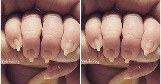 Armanik-Edu Blog Welcomes You: See the viral photo of baby born with ...