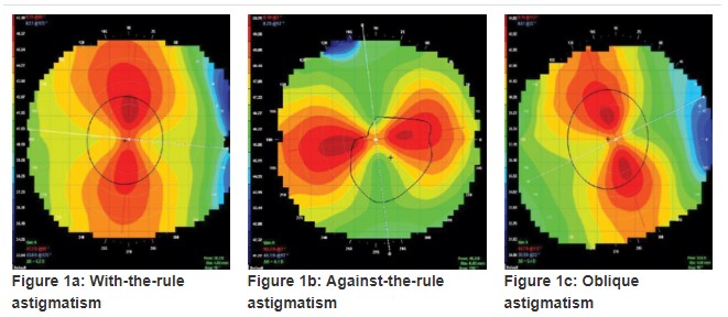 eyecing on the cake: astigmatism