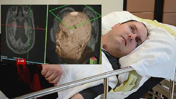 Vegetative Patient Tell Doctors He Is Not in Pain | Interesting Facts