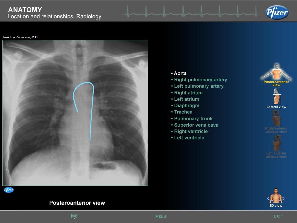 Melihat Jantung Pada Proyeksi Rontgen (Bagian I)