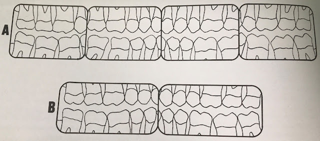 Técnica interproximal