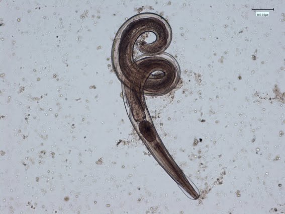 Fun With Microbiology (What's Buggin' You?): Enterobius vermicularis ...