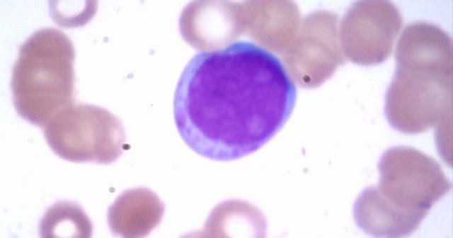 Fichero de Hematologia: Monoblasto