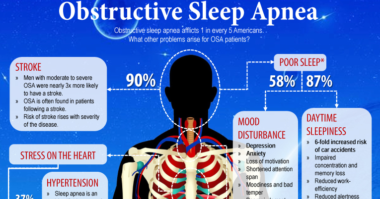 Infographic on Obstructive Sleep Apnea (OSA) | Fauquier ENT Blog