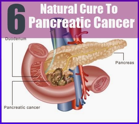 6 Natural Cure To Pancreatic Cancer ~ Mzizi Mkavu