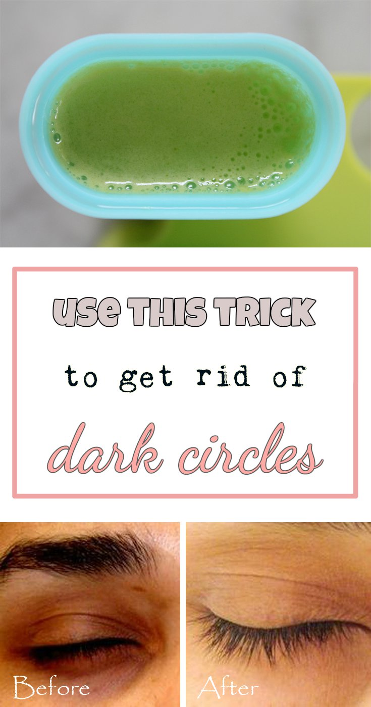 Use this trick to get rid of dark circles - BEAUTIFUL DIY AND HEALTH