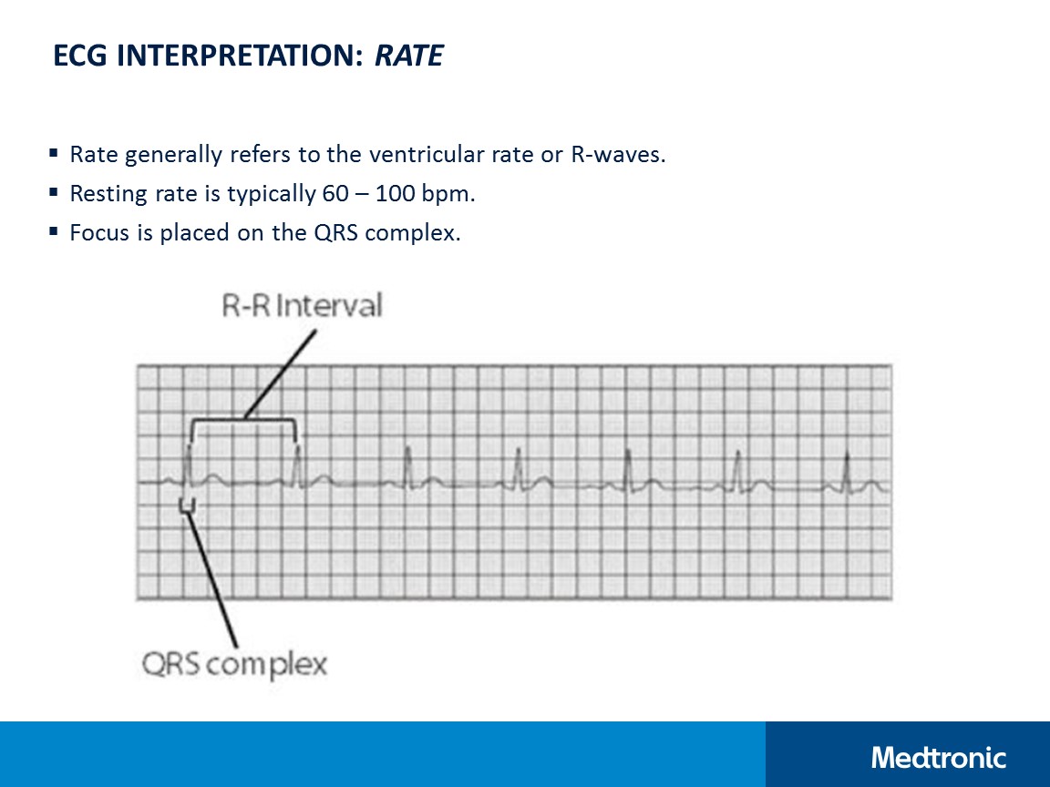 CVT Mohd Farid: Heart Rhythm Interpretation Part I-Medtronic Academy