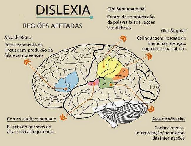 Aline Brandão Psicopedagoga: O que é Dislexia?