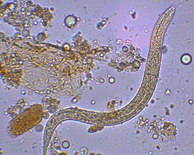 Necator_americanus ~ The WORLD