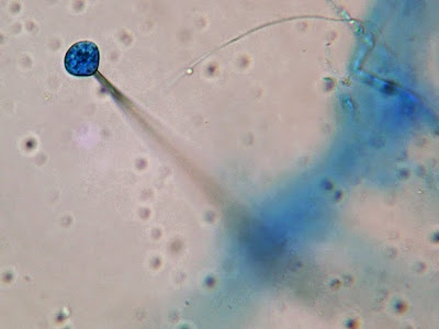 Fun With Microbiology (What's Buggin' You?): Apophysomyces elegans ...