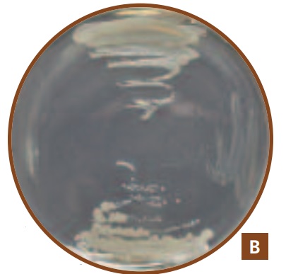 [Microbiology] Phenylethyl Alcohol Agar | Free Medical Atlas