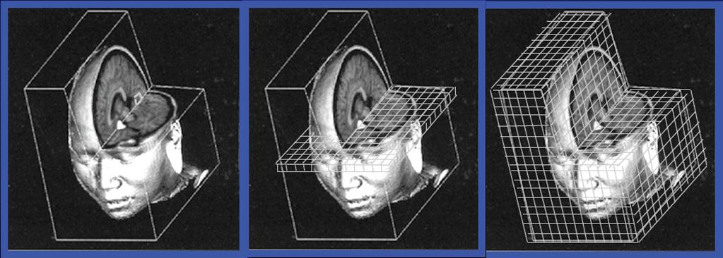 MRI and Medical Imaging: ΦΑΣΜΑΤΟΣΚΟΠΙΑ ΚΑΙ ΦΑΣΜΑΤΟΣΚΟΠΙΚΗ ΑΠΕΙΚΟΝΙΣΗ ...