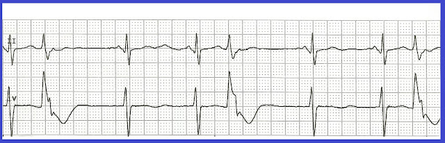 Basic EKG Rhythm Test 01