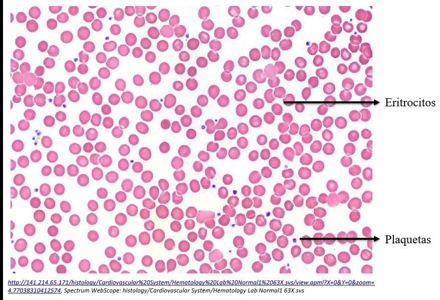 Diferencias histológicas entre las células precursoras de la sangre ...