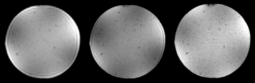 practiCal fMRI: the nuts & bolts: Common persistent EPI artifacts ...