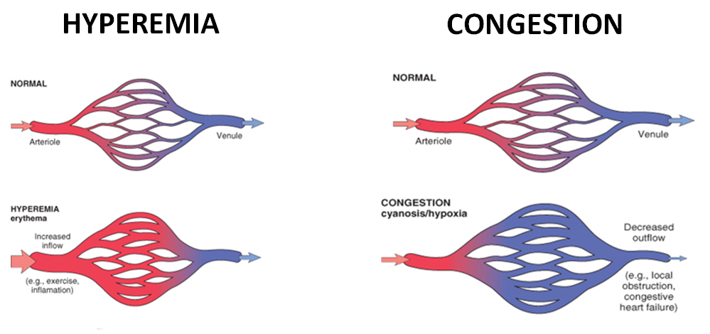 LAICI - Laboratório de Investigação de Câncer e Inflamação: Hiperemia ...