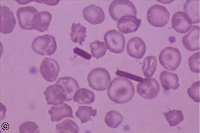 VETERINARY HEMATOLOGY DEXTERVET: hemoglobin c crystal ( elongated ...