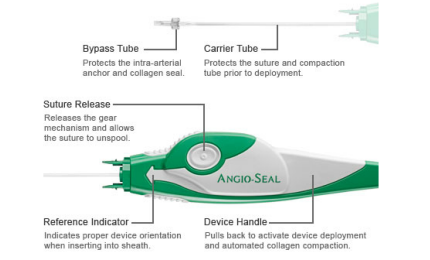 Vascular Mind : VASCULAR CLOSURE DEVICES