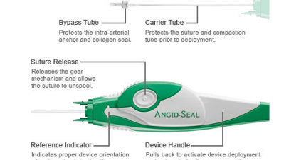 Vascular Mind : VASCULAR CLOSURE DEVICES