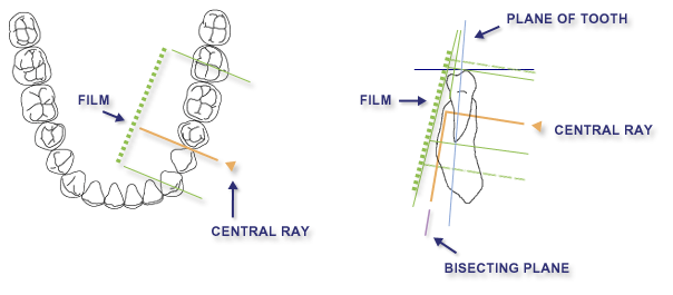 Dentistry and Medicine: Intraoral Radiographic Techniques (The ...
