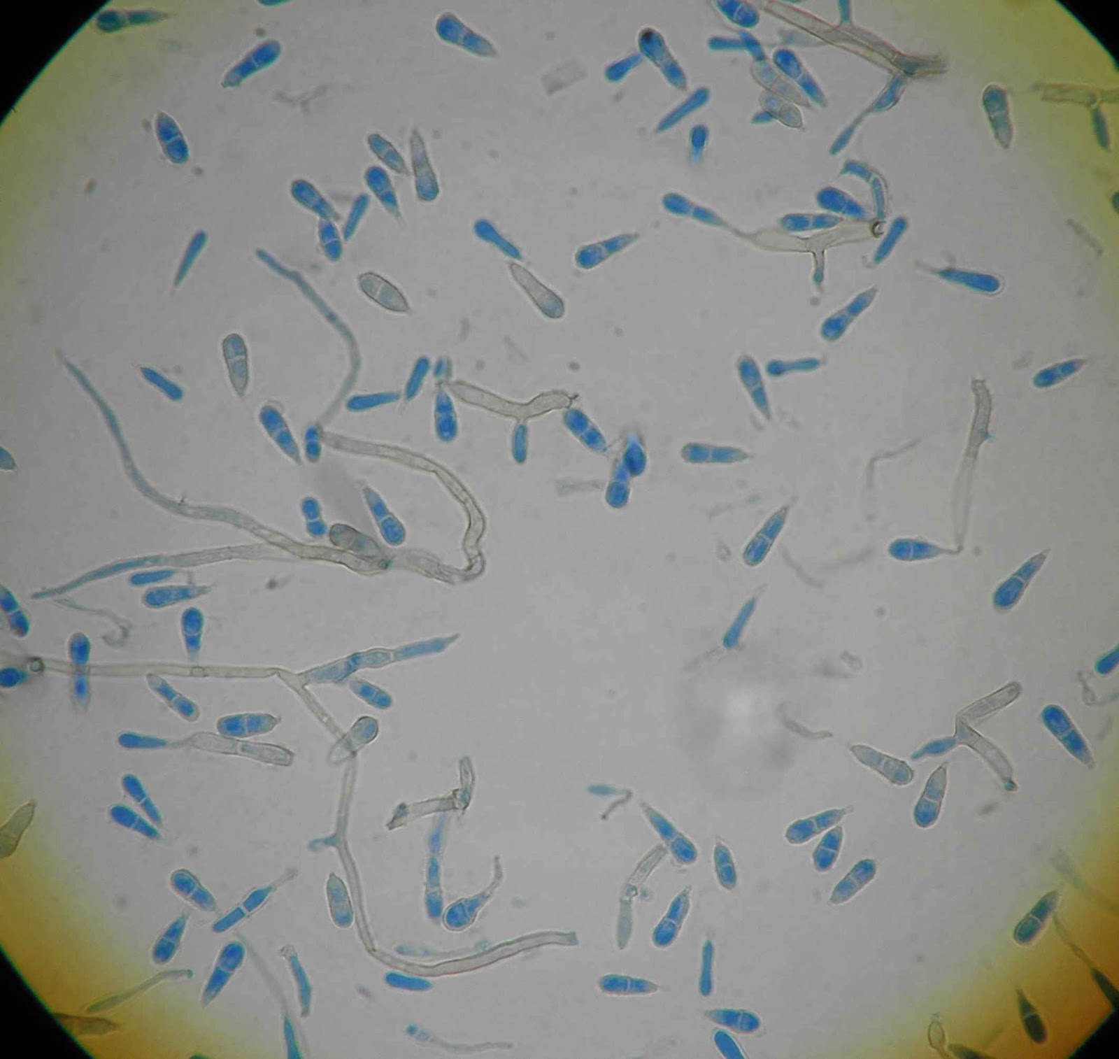 ATLAS MICOLOGIA: OCHROCONIS GALLOPAVA / VERRUCONIS GALLOPAVA