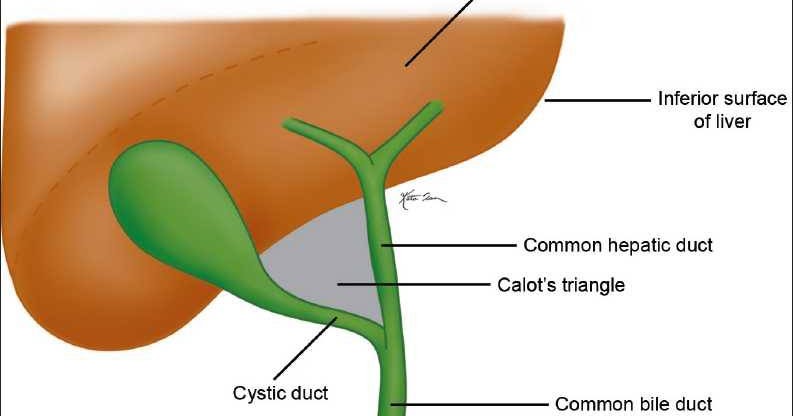 Human Anatomy: Calot's Triangle
