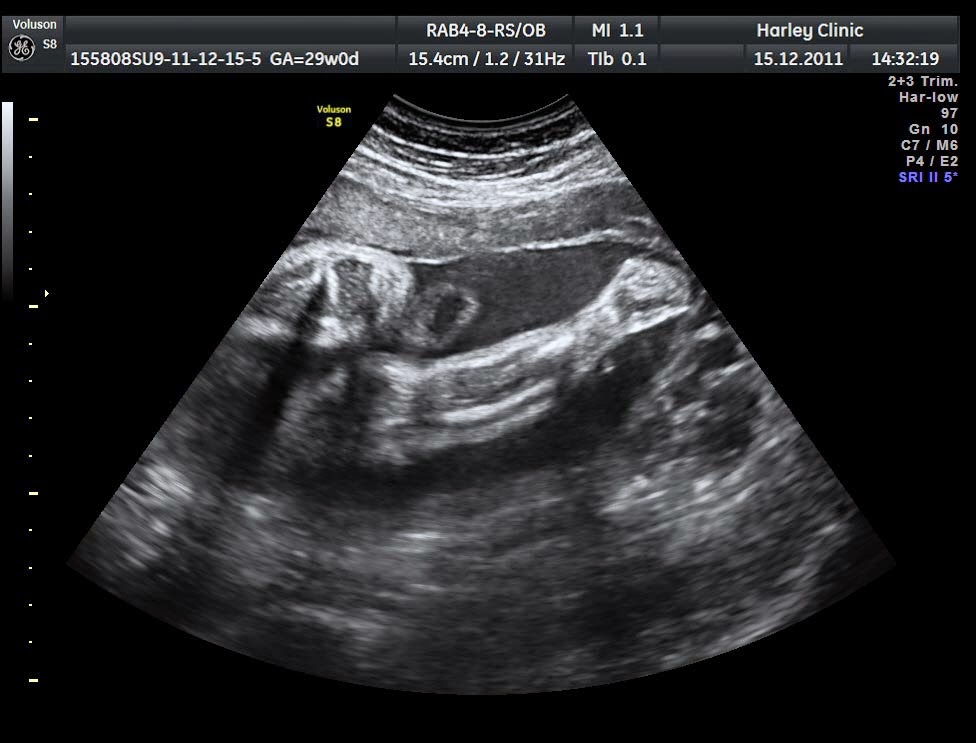 Medical Science: Early Pregnancy