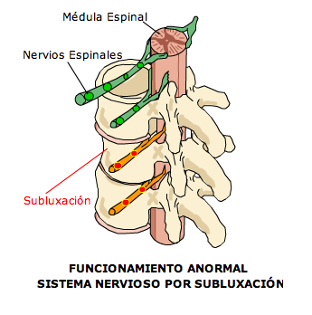 Centro Quiropractico: Subluxación vertebral