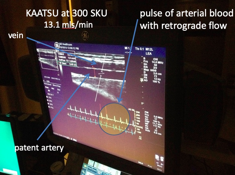 KAATSU Global Blog: KAATSU Specialist Series: Introduction To The ...