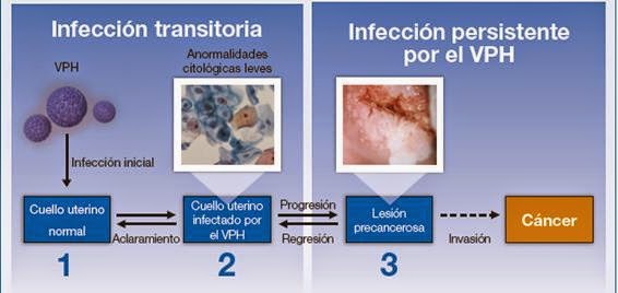 Virus del Papiloma Humano (VPH)