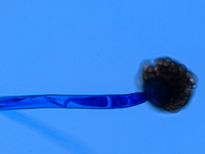 Fun With Microbiology (What's Buggin' You?): Mucor Species