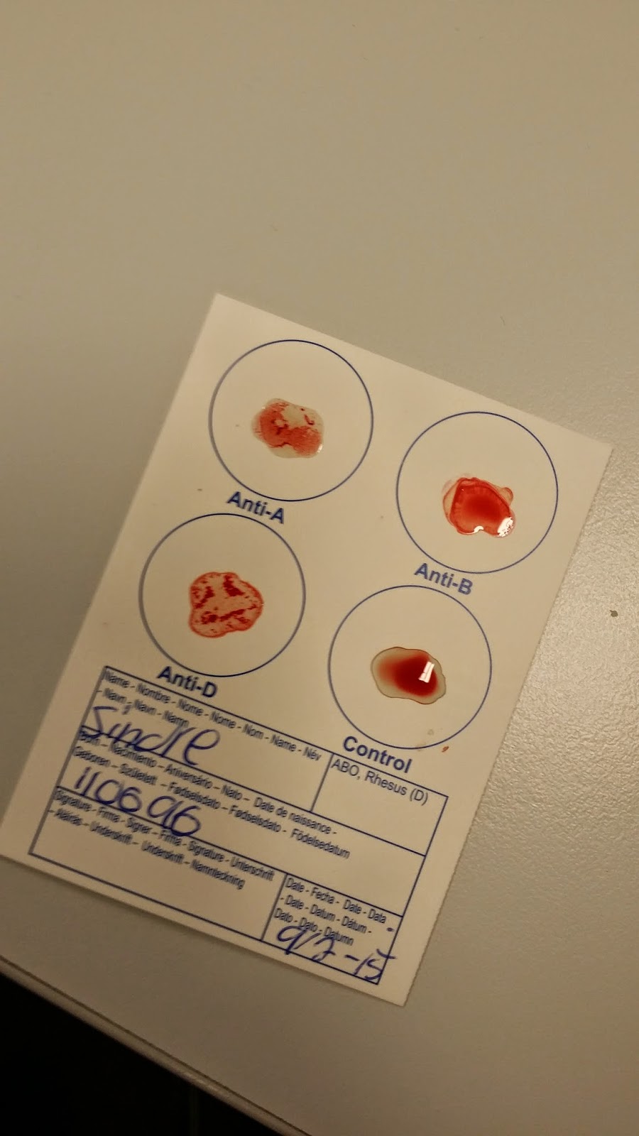 Sindres naturfagsblogg: Bestemmelse av blodtype med Eldon-kort