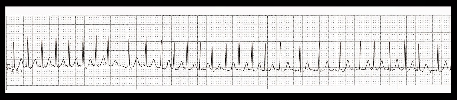 Practice EKG Strips 368