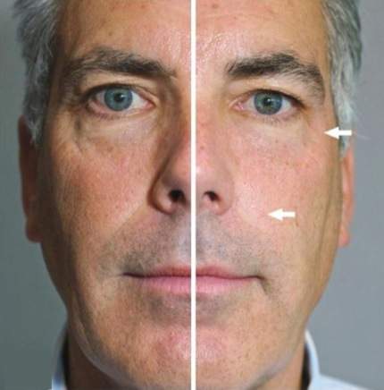 Setrika Wajah | Setrika Muka | Galvanic Spa: Setrika Wajah Galvanic Spa