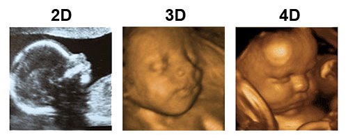 Pemeriksaan USG (Ultrasonografi) untuk Kehamilan | Medkes