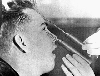 FINALIDAD DE LA LOBOTOMÍA