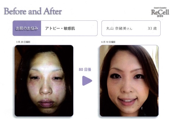 ReCell Japan ~skin regenerate beauty essence~ @ Malaysia: Japan Test ...