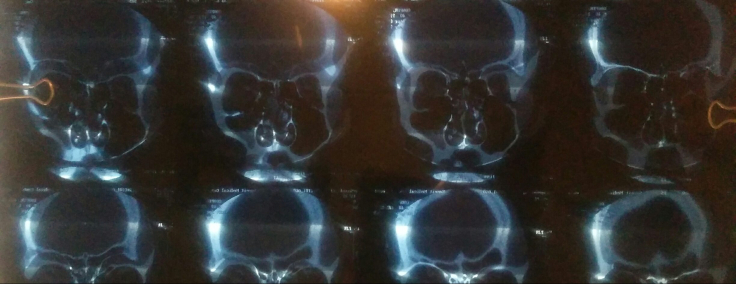 The Brain is Unremarkable