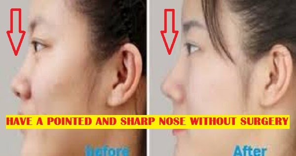 How To Make Your Nose Sharp And Pointed Without Surgery – MUST TRY ...