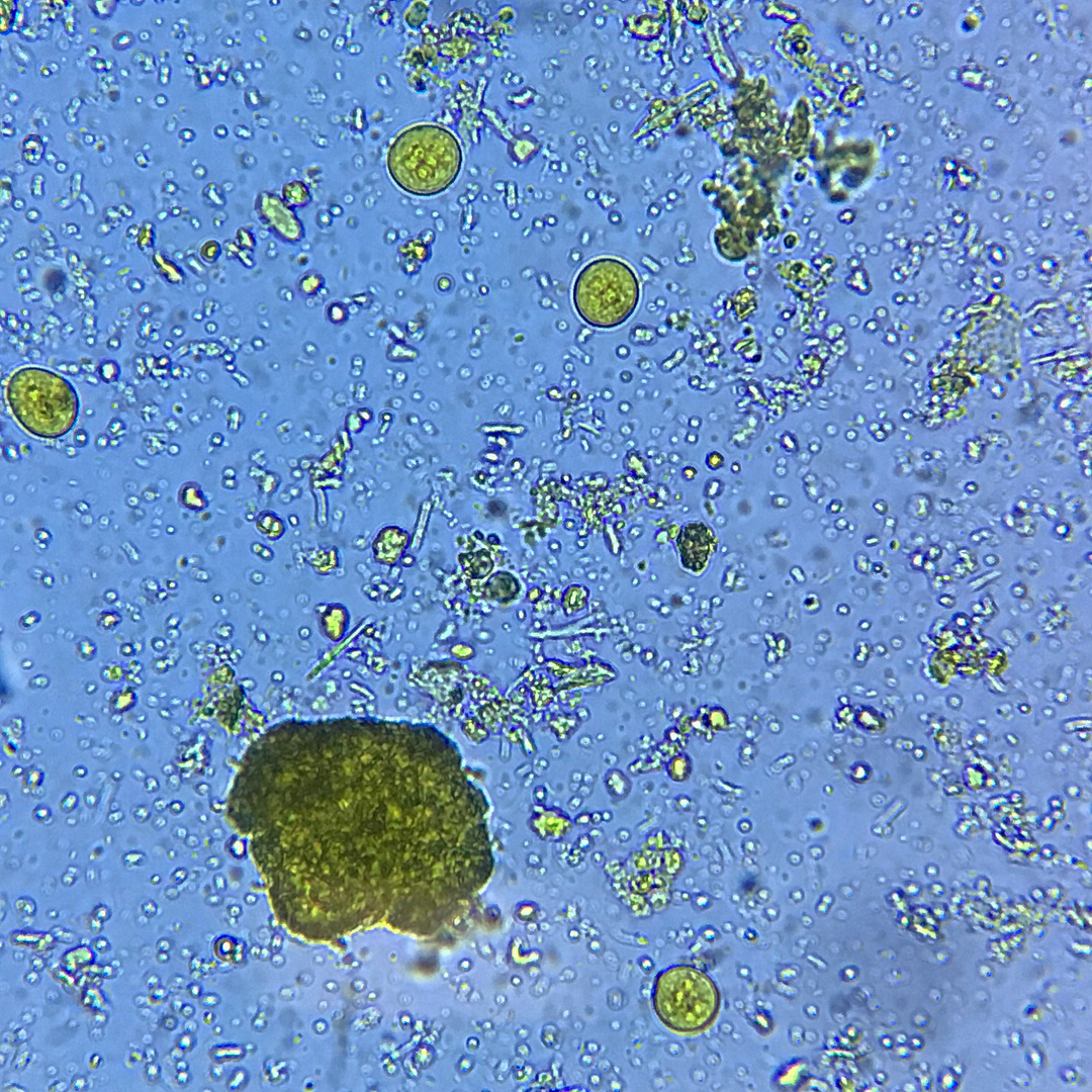 entamoeba coli tratamento - wood scribd braxin