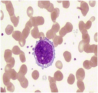 Hematologia Clínica : Atlas de Hematologia
