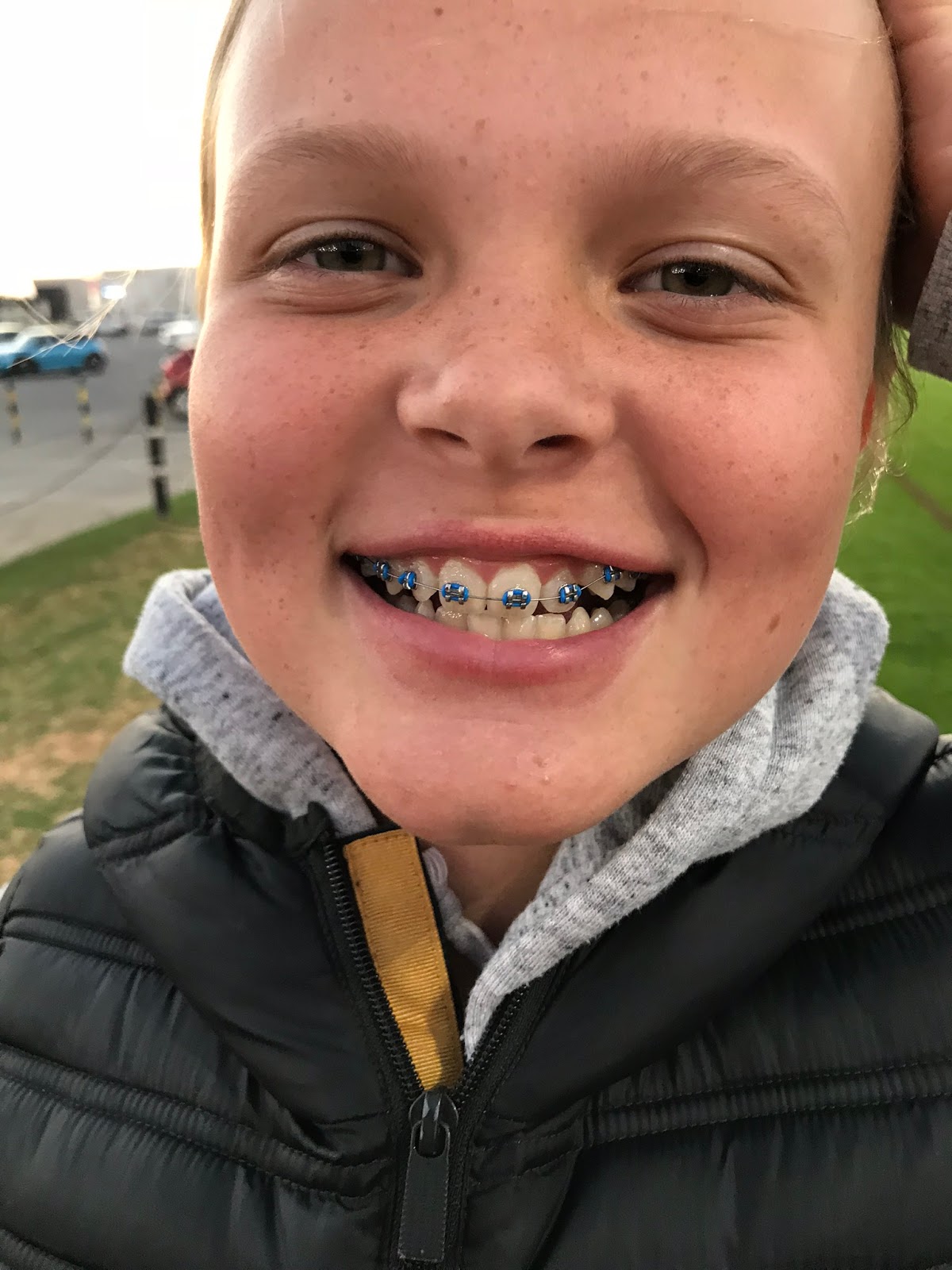 Life in Abu Dhabi: Braceface
