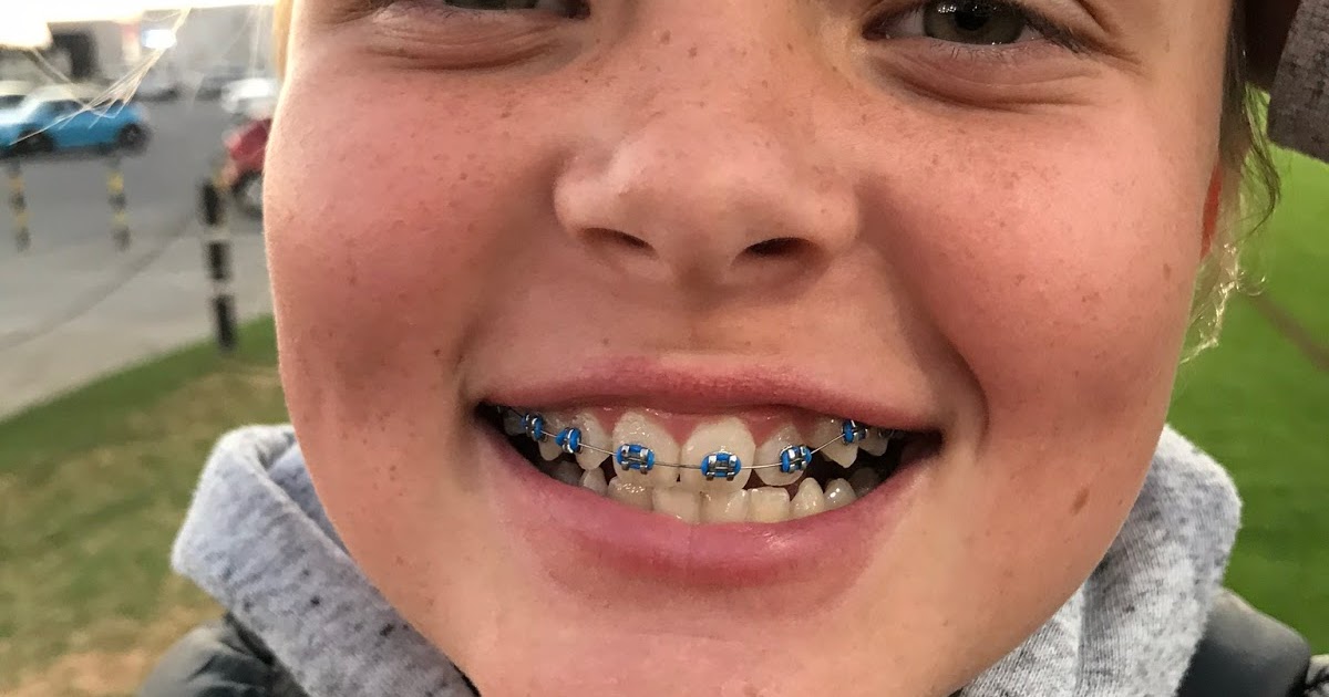 Life in Abu Dhabi: Braceface