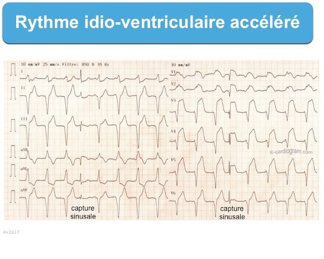 L'ETUDIANT EN MEDECINE: Les RIVA