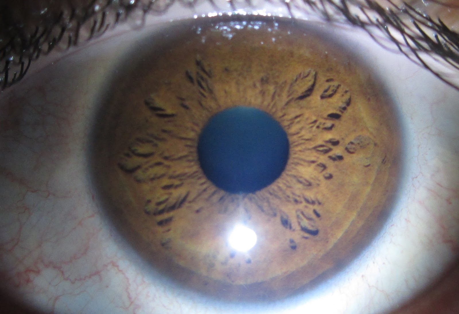 A COR DAS IRIS E SEU SIGNIFICADO