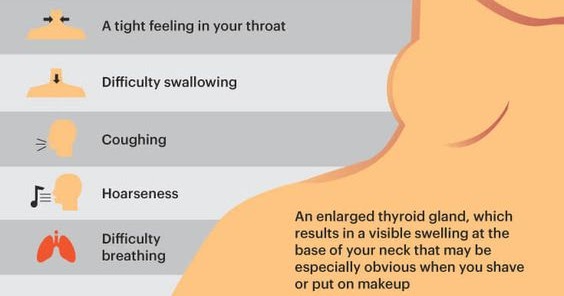 GOITER SYMPTOMS & RISK FACTORS